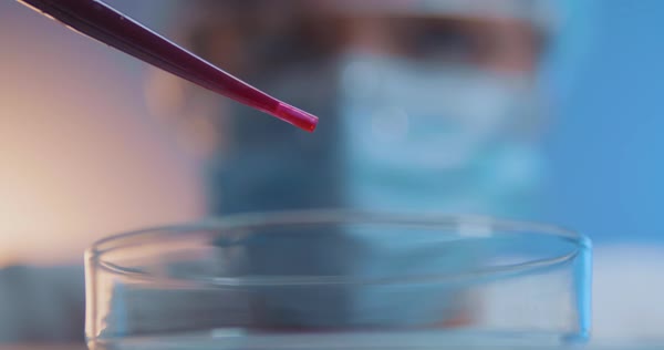 Close up shot of blood drops. Scientist in blur performing blood ...