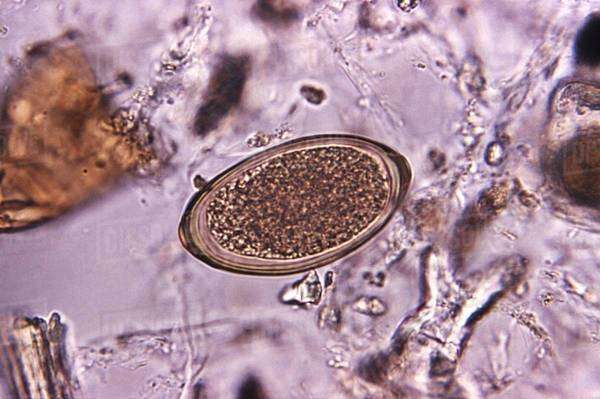 Photomicrograph of a Trichuris vulpis nematode egg magnified 500x - Royalty-free Stock Photo ...