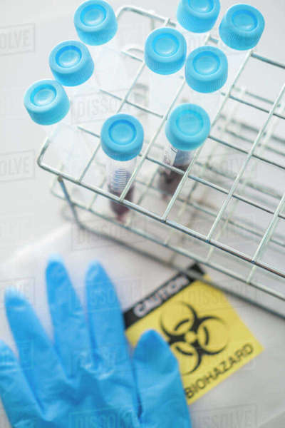 Blood samples with biohazard sign and surgical glove - Royalty-free ...