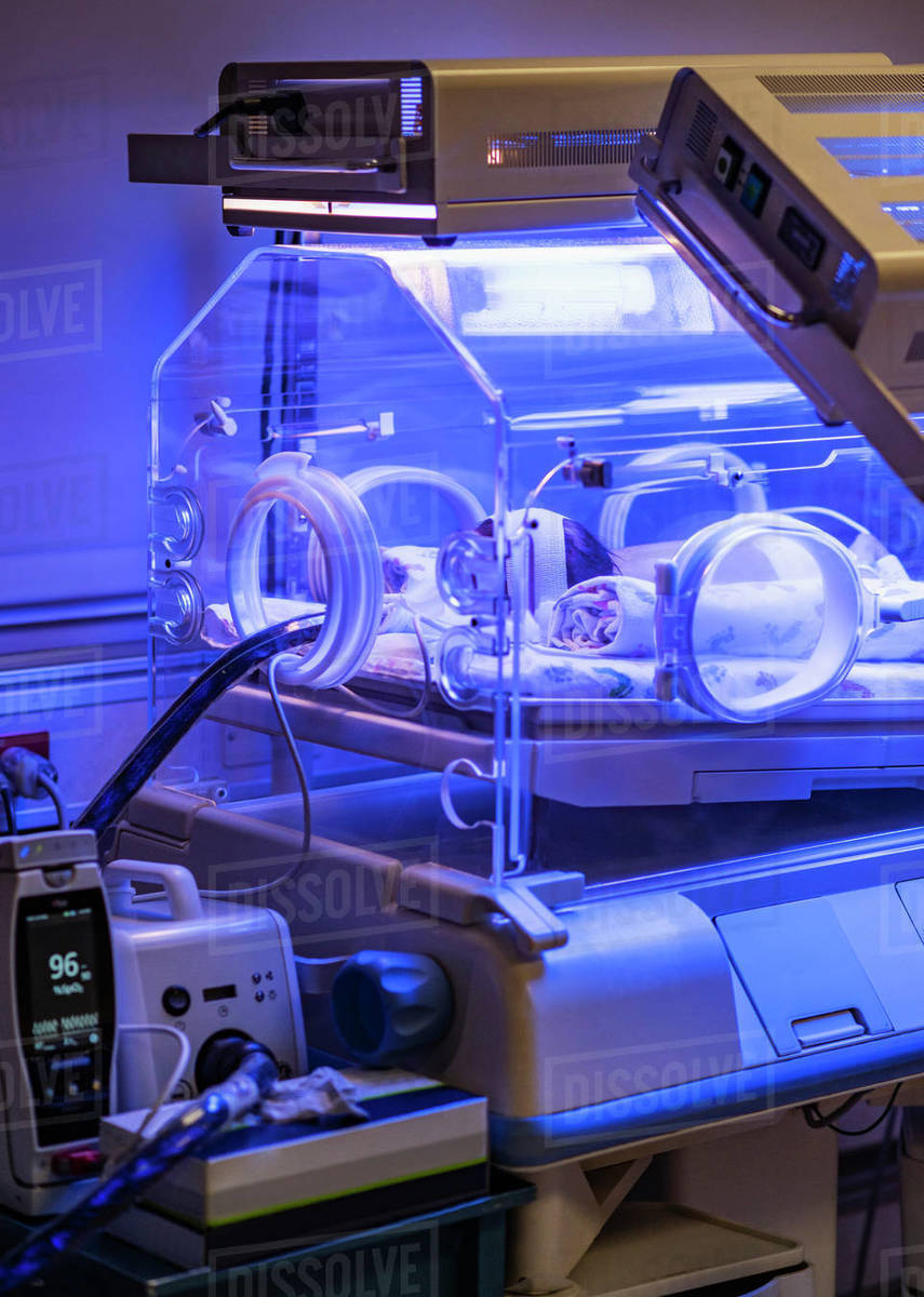 Infant baby girl (0-1 months) treated for jaundice in incubator - Stock ...
