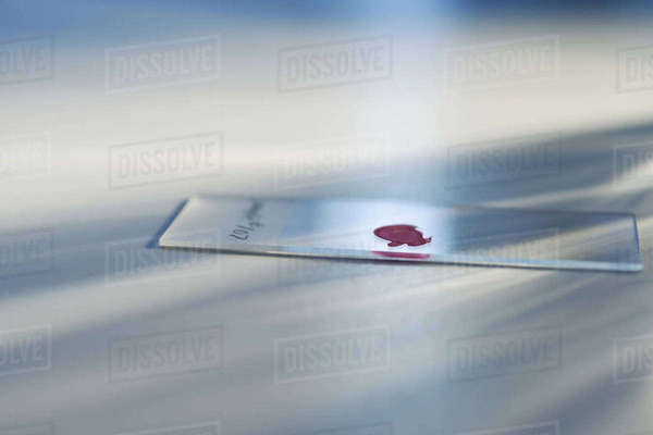 Drop of blood on slide - Royalty-free Stock Photo | Dissolve