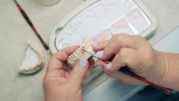 Dental cast model is getting made by a doctor - 4K Royalty-free Stock ...