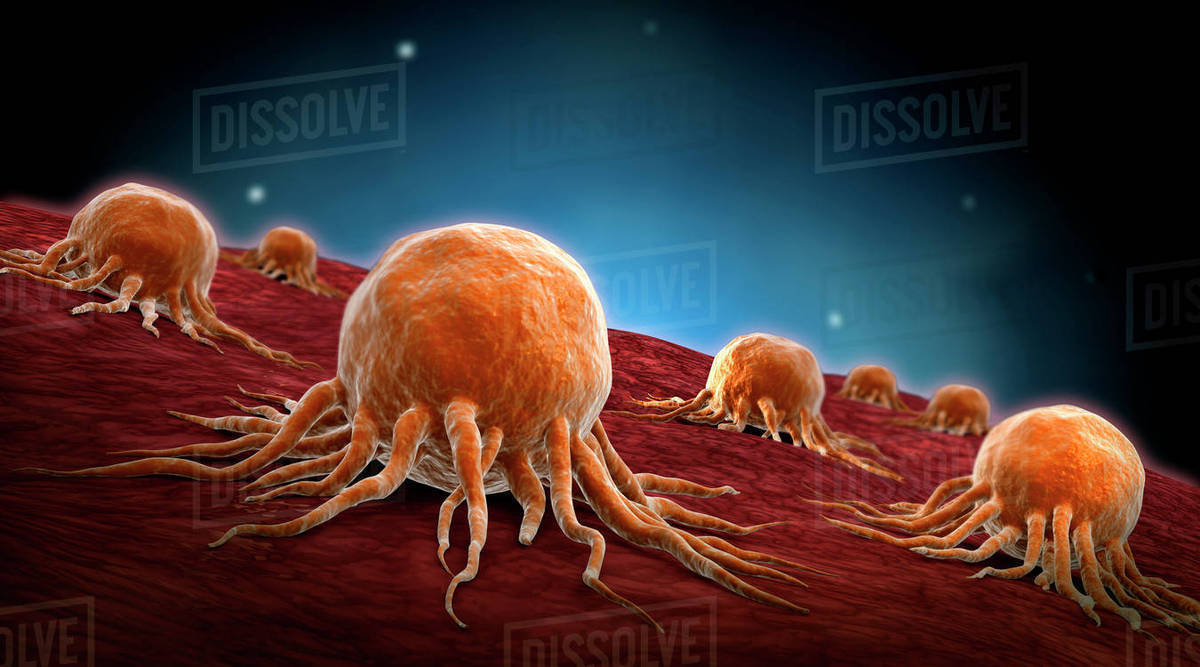 Conceptual image of cancer virus. - Stock Photo - Dissolve