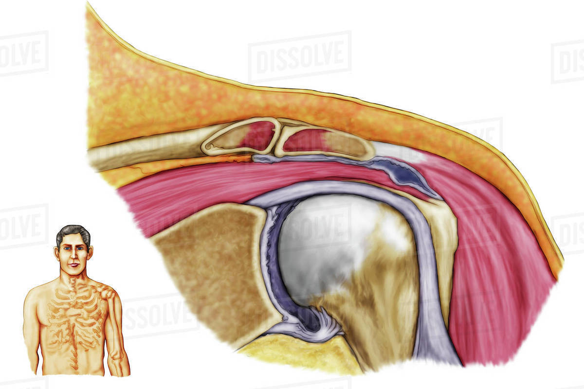 Anatomy of left shoulder, coronal view. - Stock Photo - Dissolve