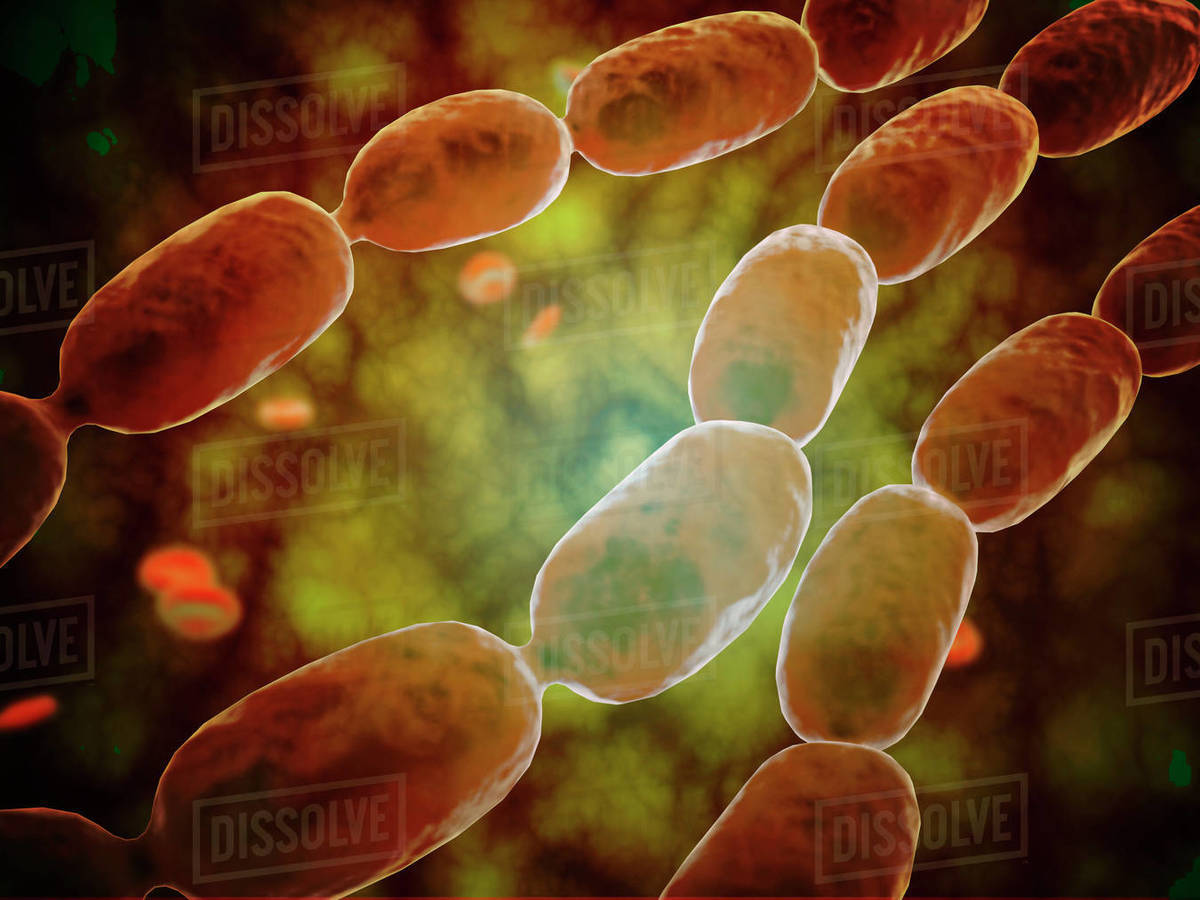 Microscopic view of bacterial pneumonia. Bacterial pneumonia is a type ...