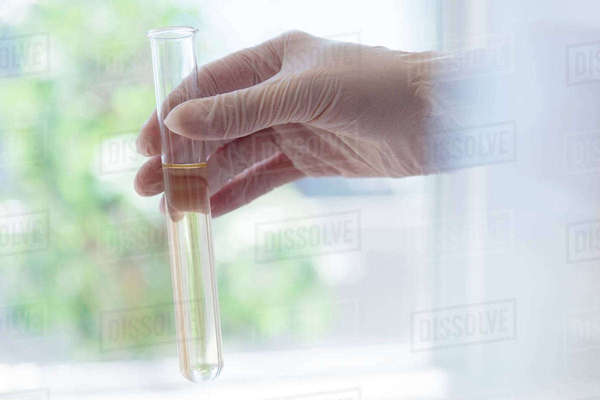 Hand holding test tube with yellow liquid - Royalty-free Stock Photo ...