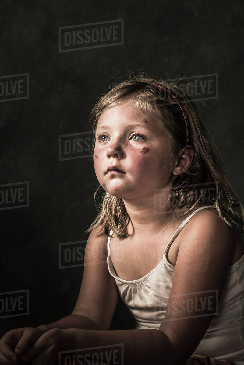 Sad Caucasian girl with scratches on her face - Stock Photo - Dissolve