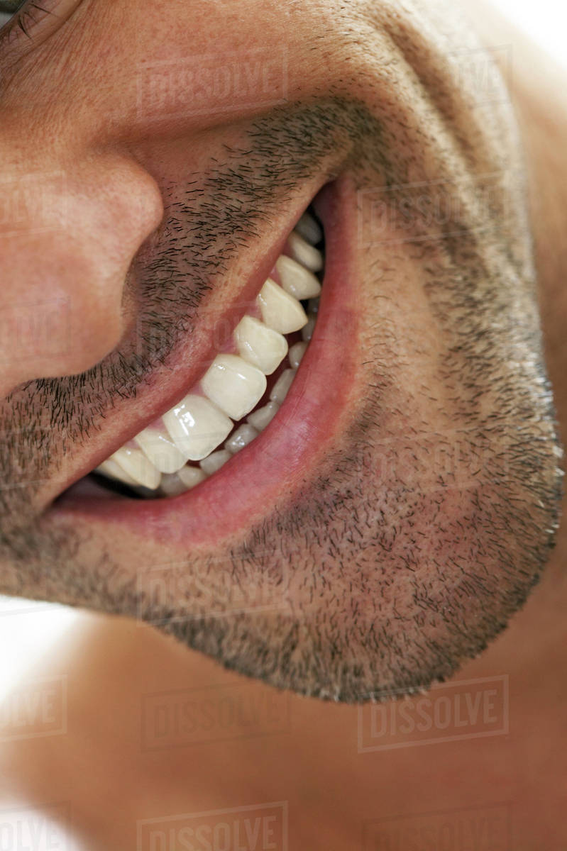 Close up of man's smile - Royalty-free Stock Photo | Dissolve