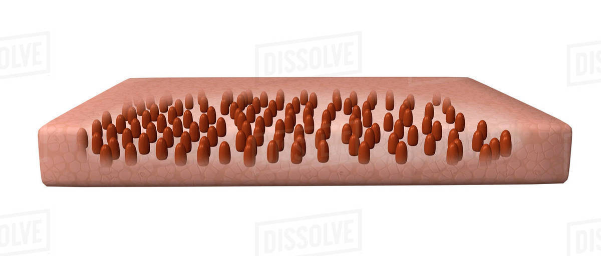 At a lower level of the epidermis are pigmentation cells called ...