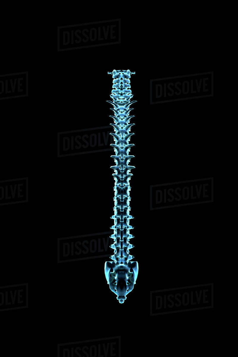 Male human spinal column from rear in blue X-ray by Hank Grebe ...