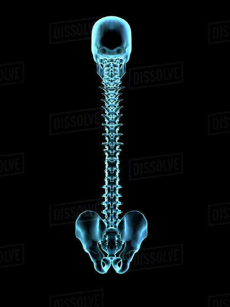 X-Ray of human hip and skull, Digitally Generated Image by Hank Grebe ...