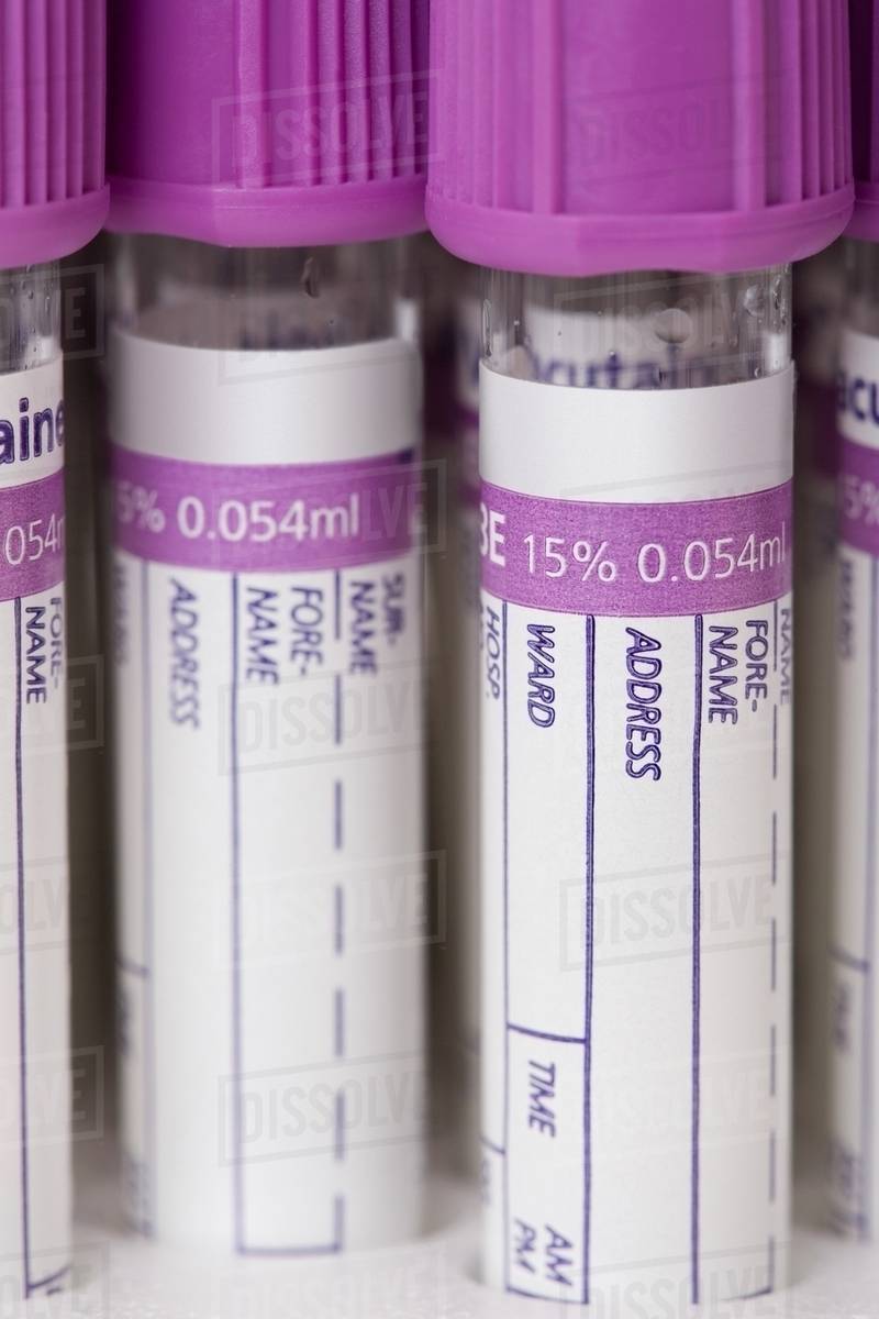 Sample bottles - Royalty-free Stock Photo | Dissolve