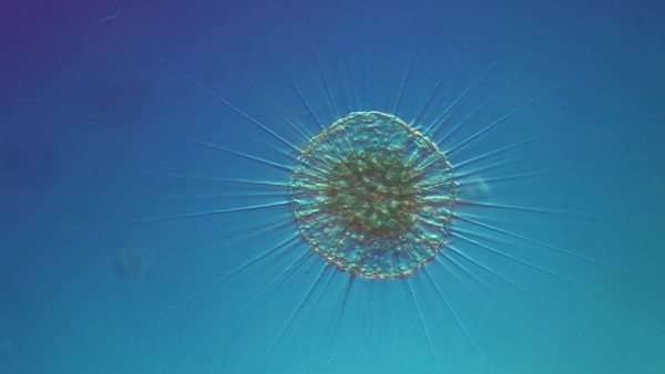 Actinosphaerium is a heliozoan protozoan with radiating pseudopodia ...
