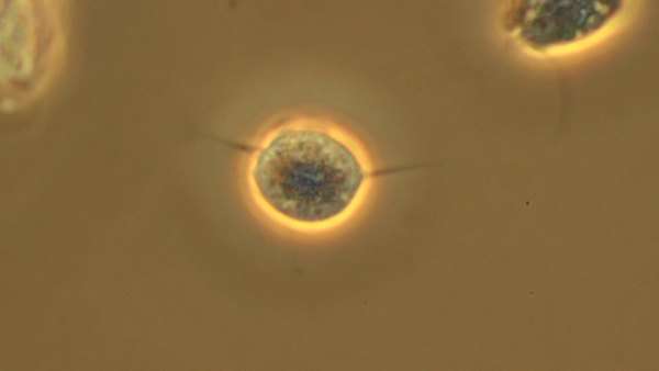 Trichomonas vaginalis parasite, light microscopy - HD Rights-managed ...