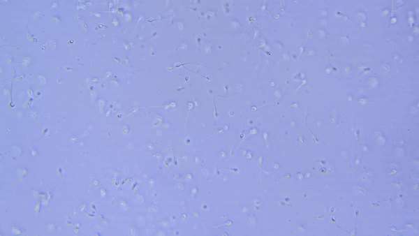 Microscopic footage of human sperm, the male reproductive cells - HD ...