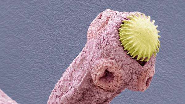 Animated scanning electron micrograph (SEM) of a tapeworm (Taenia ...