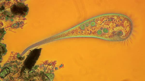 Ciliates on algae. Light microscope footage of ciliate protozoa moving ...