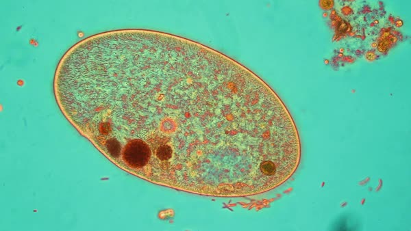 Ciliates on algae. Light microscope footage of ciliate protozoa moving ...