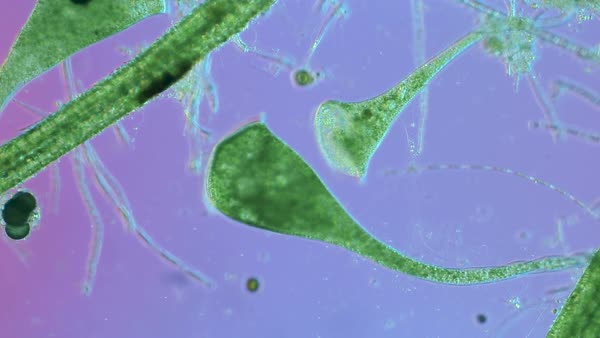 Stentor protozoa feeding on green algae. Light microscopy of the ...