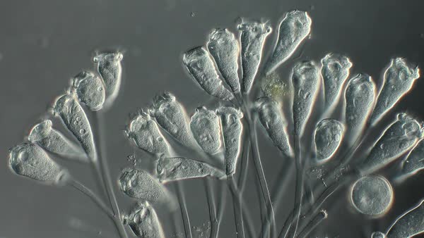 Epistylis ciliates. Differential interference contrast (DIC) light ...