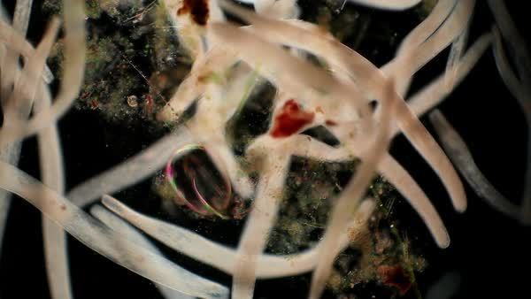 Nematodes Light Microscopy Of Nematodes In A Water Sample Hd Rights