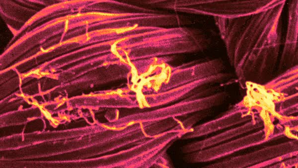 Animated coloured scanning electron micrograph (SEM) of woven silk ...