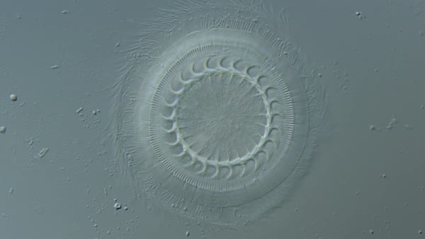 Light microscope footage of Trichodina pediculus, a peritrich ciliate ...