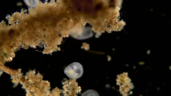 Trichomonas vaginalis parasites, light microscopy - Stock Video Footage ...