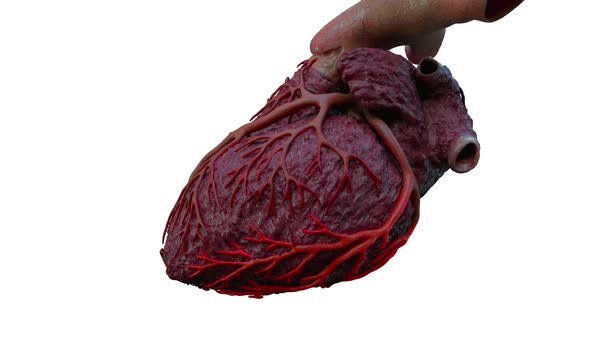 Coronary arteries, obtuse marginal artery - Stock Video Footage - Dissolve