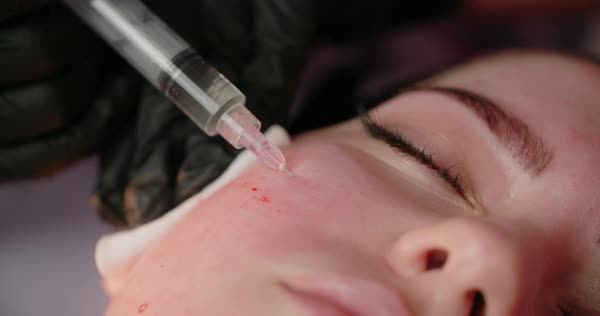 Beautician does injections to the woman's face, botox and hyaluronic ...