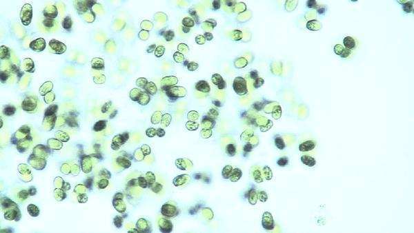 Microscopic view of Phormidium sp. blue green algae as they slowly into ...