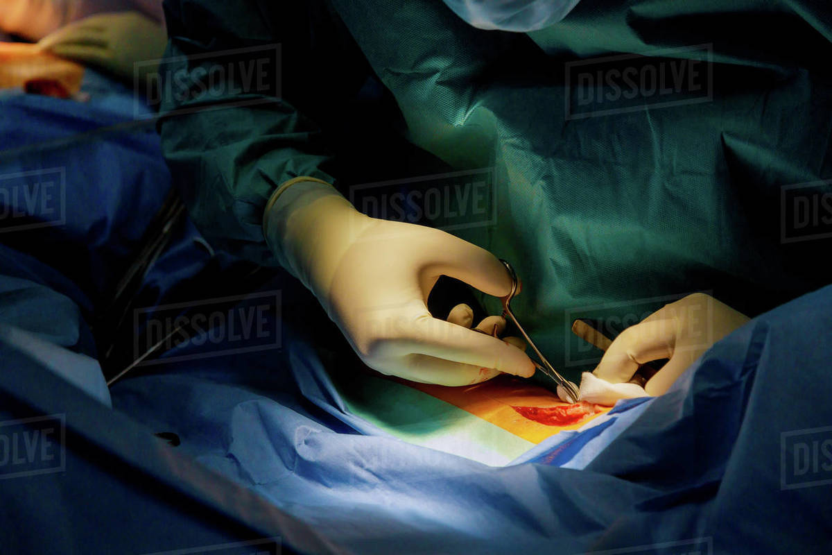 Patient with a cutting our incision a little deeper human leg with ...