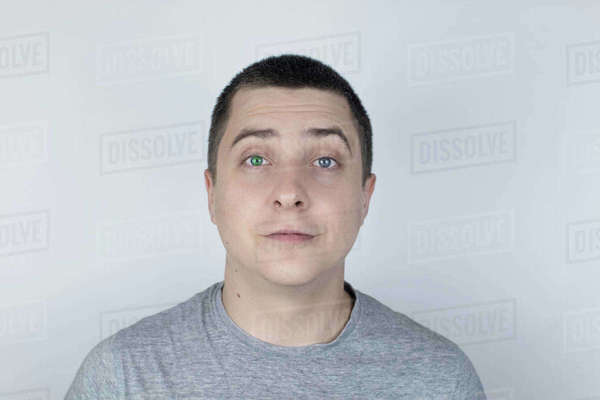 A man with different color eyes looks into the frame. The right eye is ...