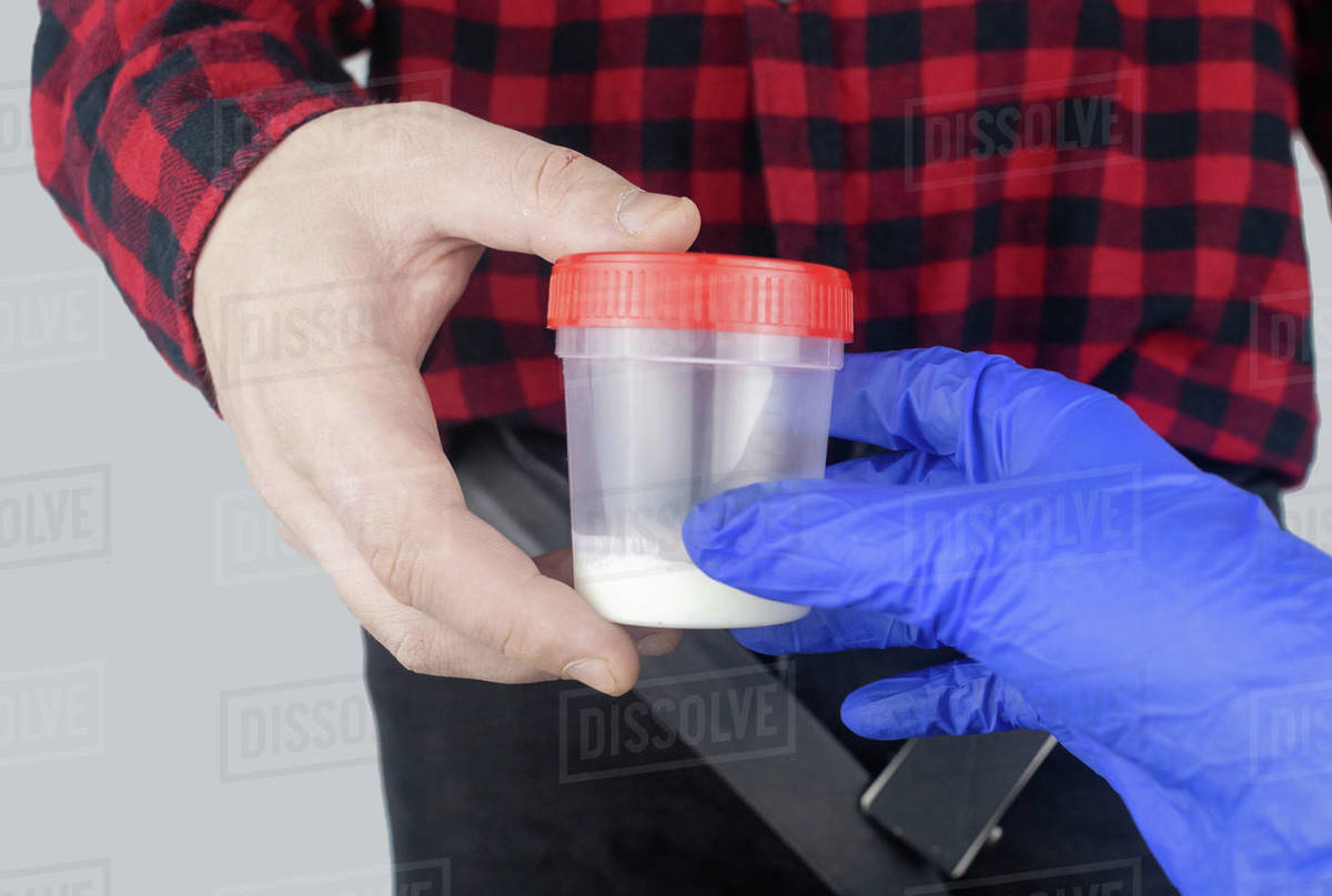 Man takes semen analysis. Spermogram. Concept. Male with his pants ...