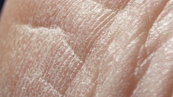 CLOSE UP MACRO: Detail of dry cracked Caucasian skin on person's feet ...