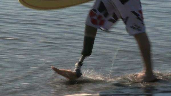 Amputee surfer on the beach - Stock Video Footage - Dissolve