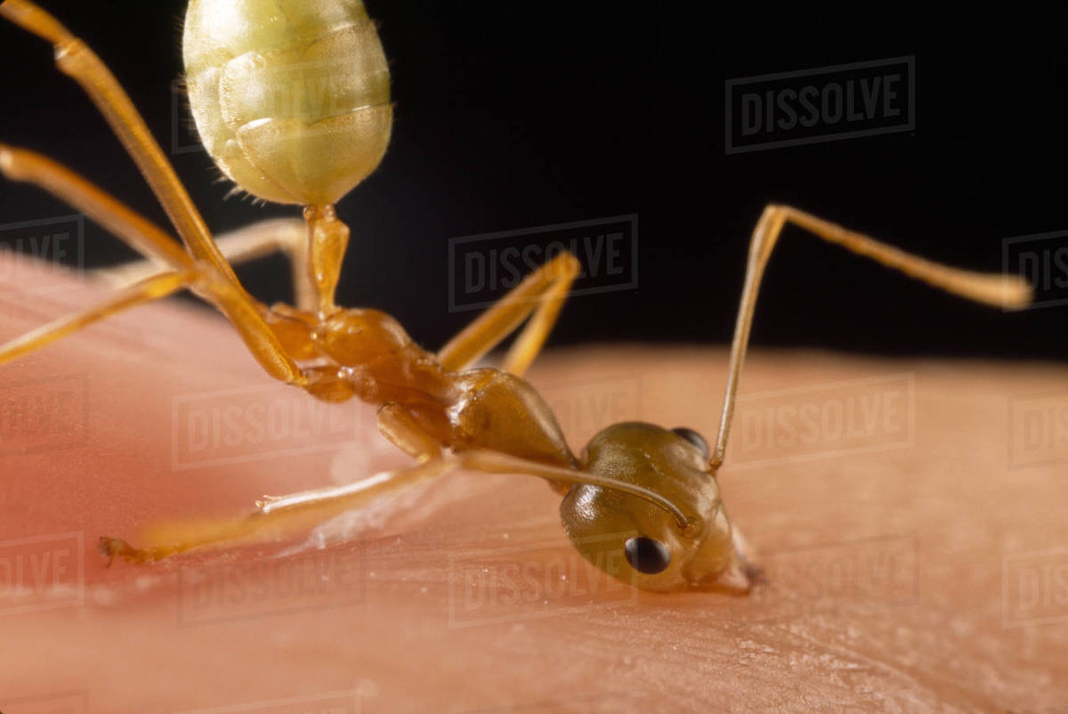 A green tree ant squirts acid into a bite on human skin.; North ...