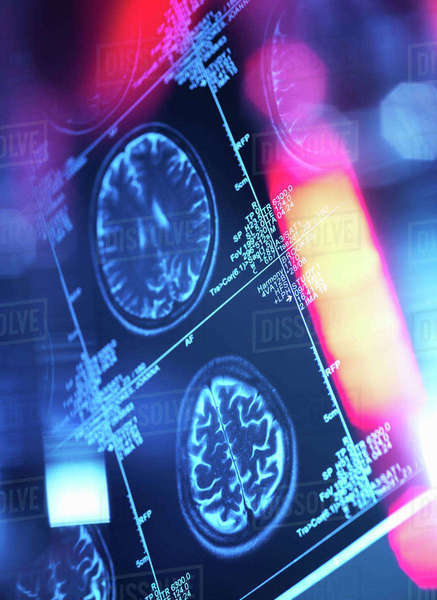 Human brain scan in a neurology clinic - Royalty-free Stock Photo ...