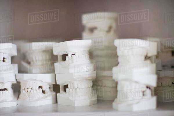Plaster models of teeth - Royalty-free Stock Photo | Dissolve
