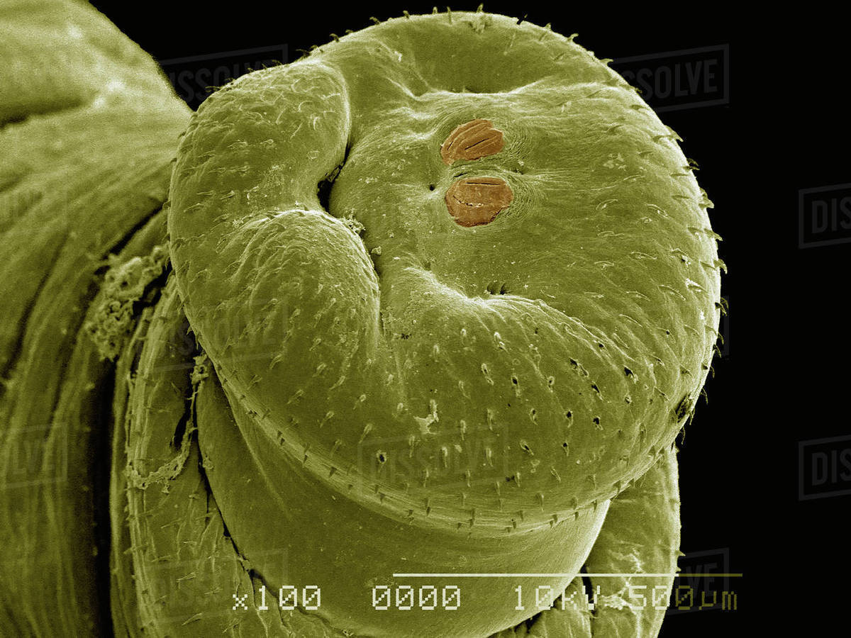 Scanning electron micrograph of the posterior spiracles of a human bot ...