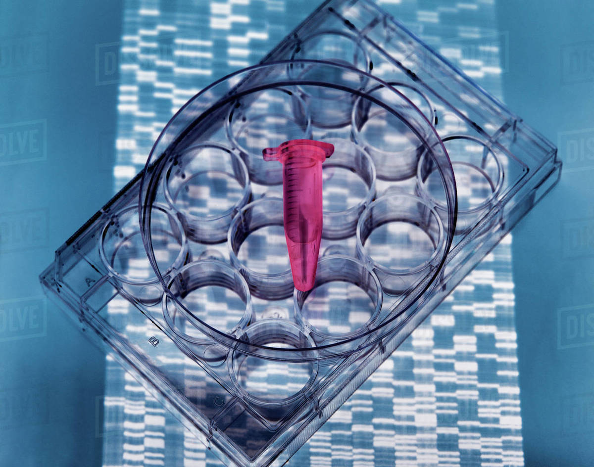 DNA sample inside vial on multi well plate, DNA gel showing results ...