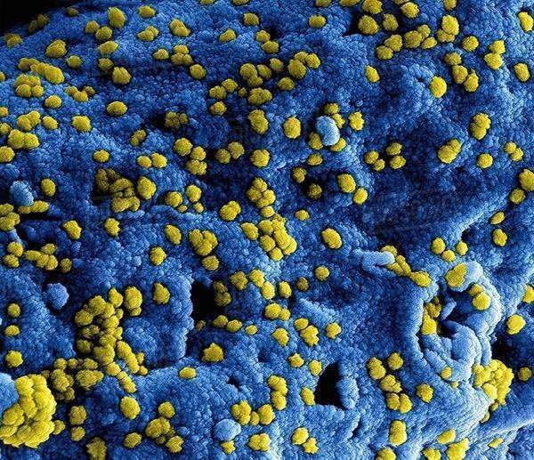 Colorized SEM showing numerous Middle East respiratory syndrome ...