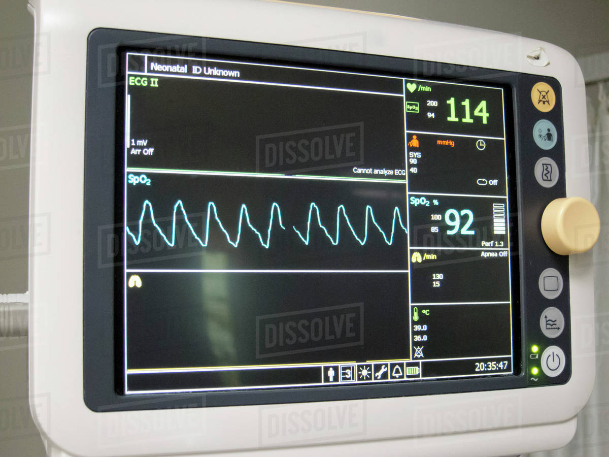 Heart monitor - Stock Photo - Dissolve