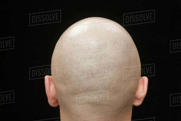 Rear view of the shaved head of a man - Royalty-free Stock Photo | Dissolve